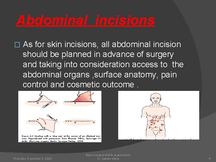 BASIC SURGICAL SKILLS AND ANASTOMOSIS Dr Zaeem Fezea