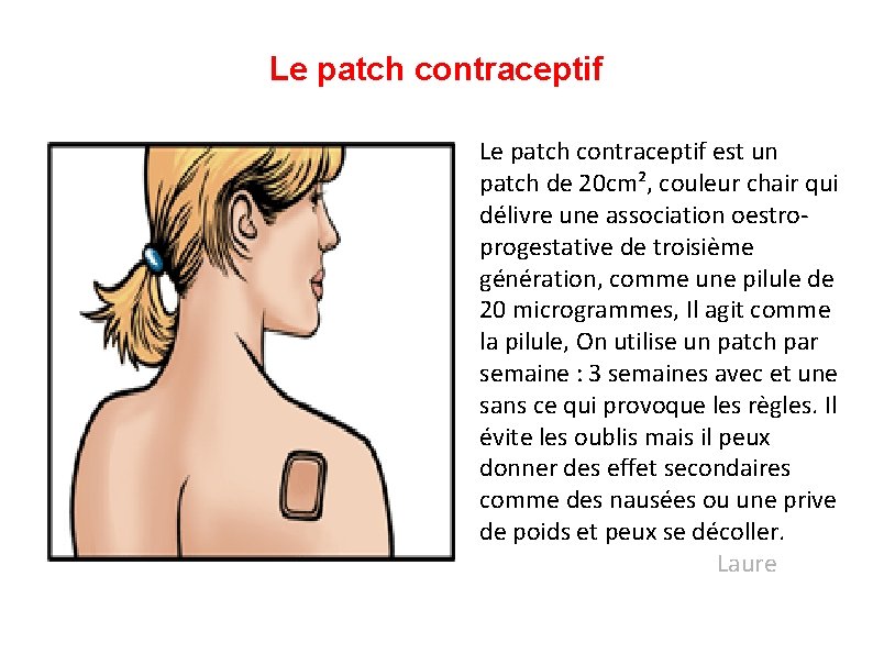 La contraception Diaporama ralis par la classe de