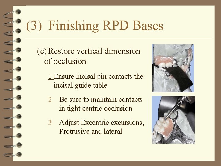 Fabricating Removable Partial Denture Bases 1 Factors Affecting