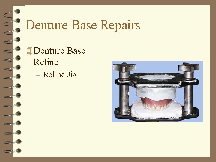 Fabricating Removable Partial Denture Bases 1 Factors Affecting