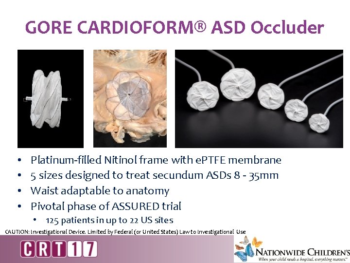 Novel Transcatheter Technologies for Congenital Heart Disease Whats