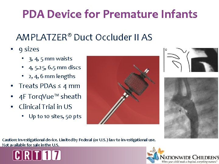 Novel Transcatheter Technologies for Congenital Heart Disease Whats