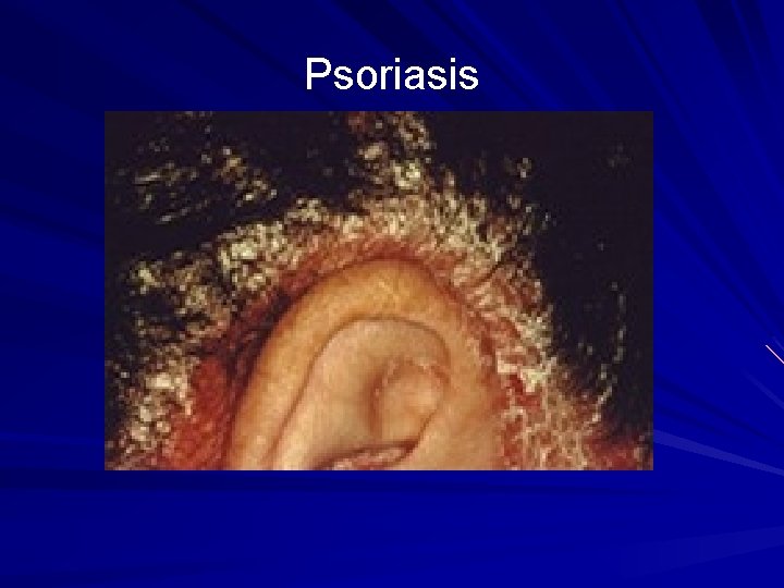 Physical Diagnosis Scalp Ears Nose and Sinuses Describe