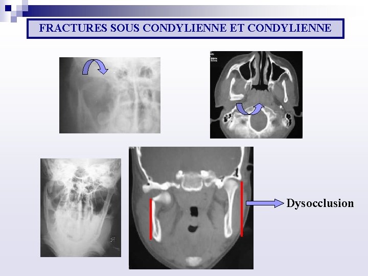 LES TRAUMATISMES DE LA FACE DR MRAD DALI