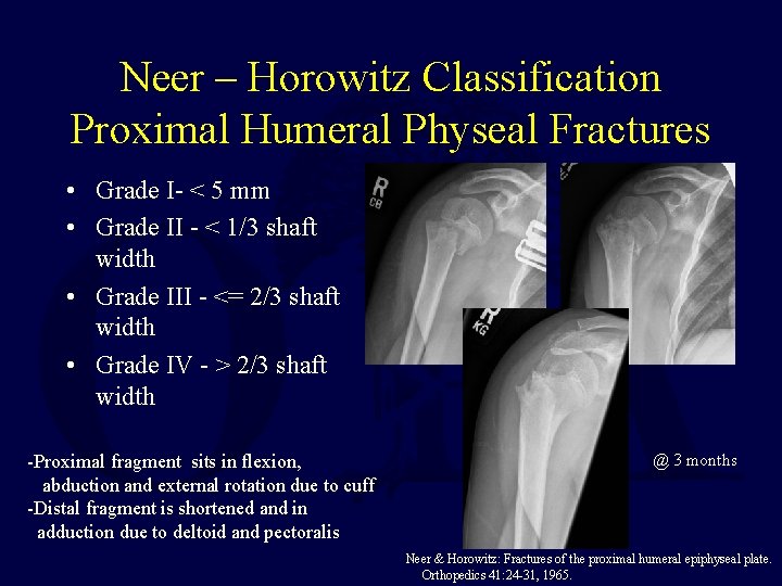 Fractures and Dislocations about the Shoulder in the