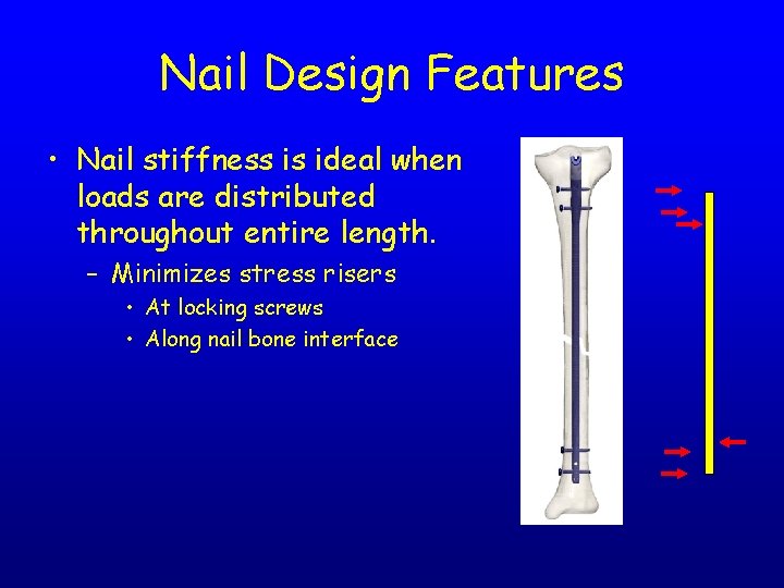 Intramedullary Nailing Basic Principles Presented by Michael Sochacki