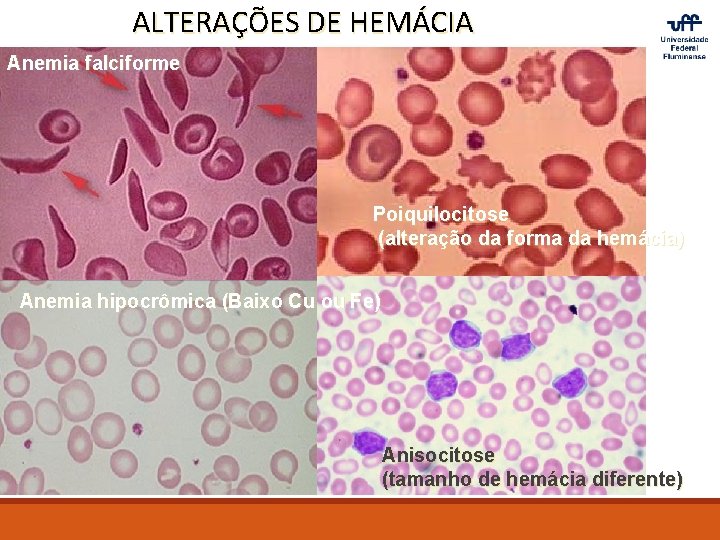 FISIOLOGIA DO SANGUE HEMACIAS E LEUCCITOS ELYZABETH DA