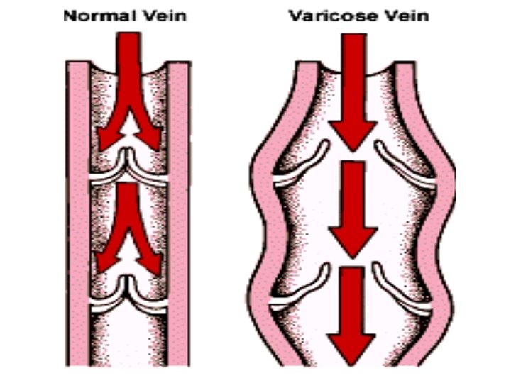 PHYSIOLOGIE DE LA CIRCULATION VEINEUSE LES VEINES SYSTMIQUES
