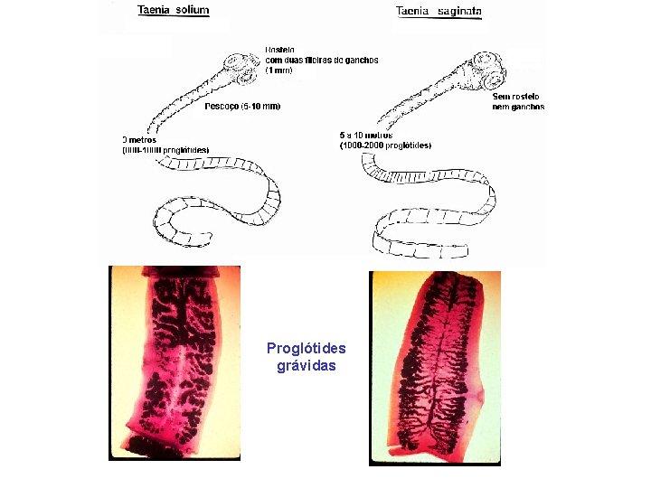 Cestides Taenia Solium Taenia Saginata Vampyrolepis Nana Diphyllobothrium