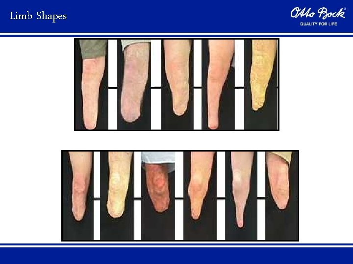 www ottobock com Some Things Never Change The