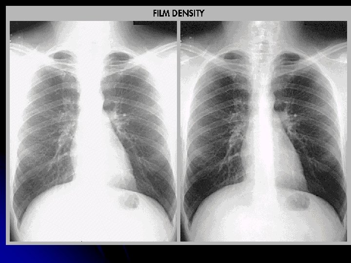 Components of Radiographic Image Quality Radiologic Technology 244
