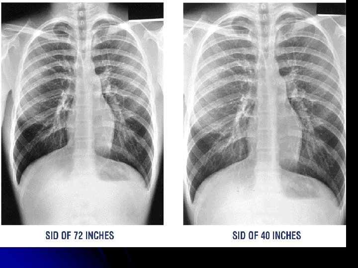 Components of Radiographic Image Quality Radiologic Technology 244