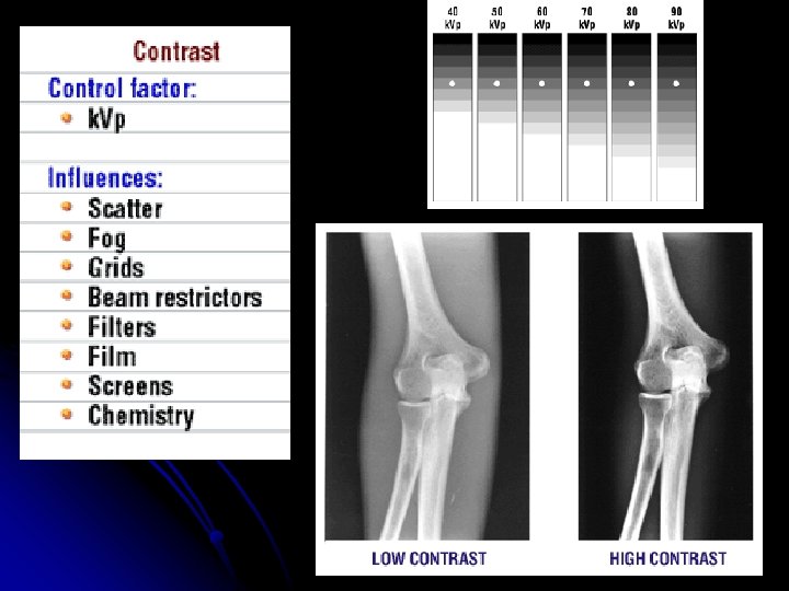 Components of Radiographic Image Quality Radiologic Technology 244