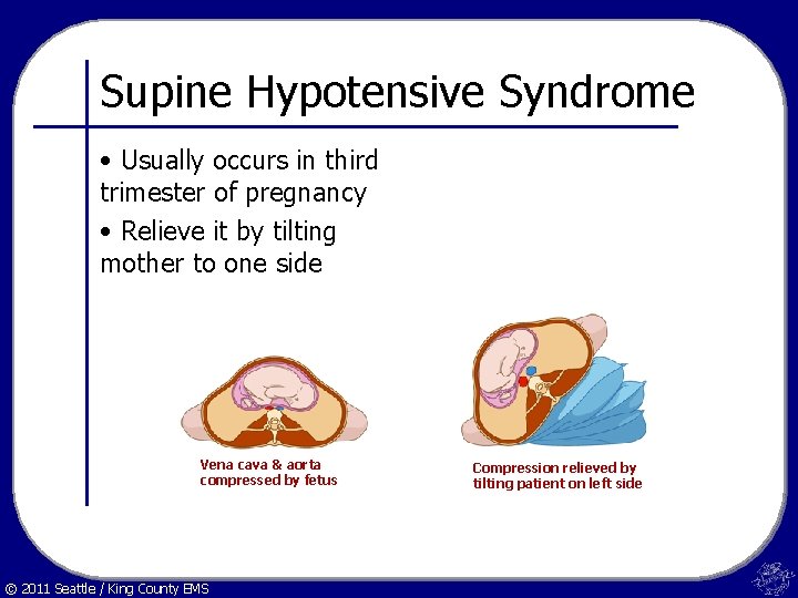 CBT 521 EMT 11 OBGYN Emergencies 2010 Seattle