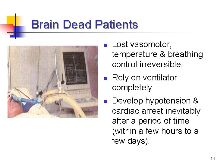 Brain Death Concept and Certification Yan Wing Wa