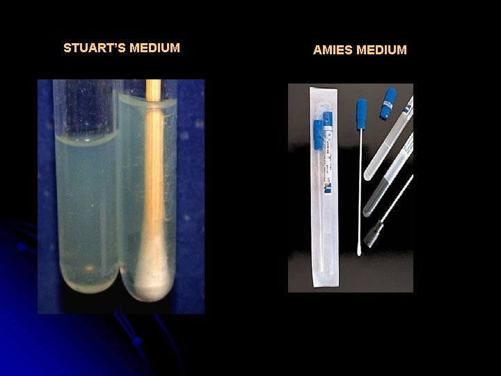 PERSIAPAN PASIEN UNTUK PENGAMBILAN SPECIMEN PEMERIKSAAN MIKROBA Oleh