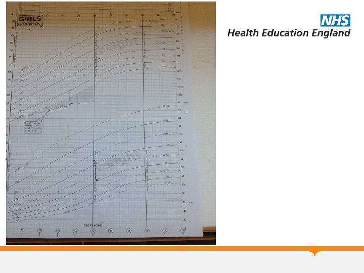 Eating Disorders Dr Katharina Junejo ST 6 Child