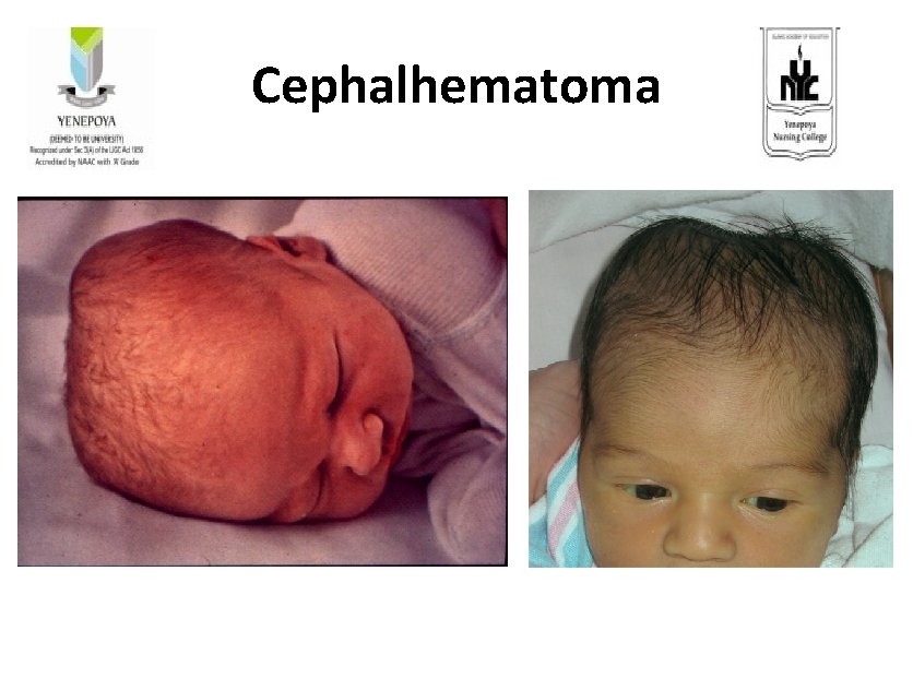 NURSING CARE OF A NEONATE Presented by Mrs