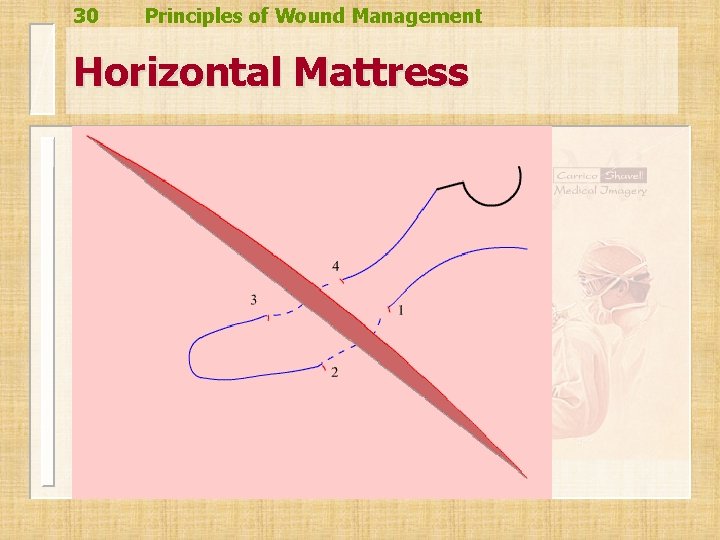 Wound Management UNC Emergency Medicine Medical Student Lecture