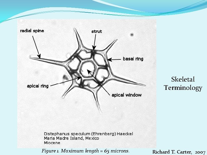 The silicoflagellate genus Distephanus Distephanopsis Robert Baldwin ...