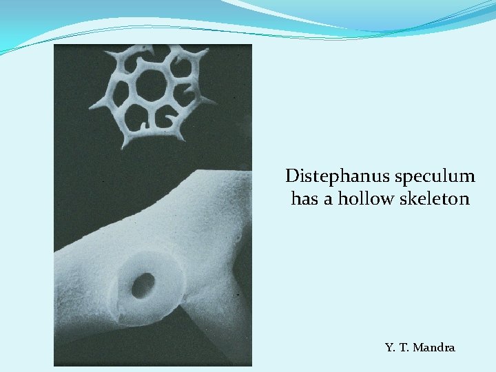 The silicoflagellate genus Distephanus Distephanopsis Robert Baldwin ...