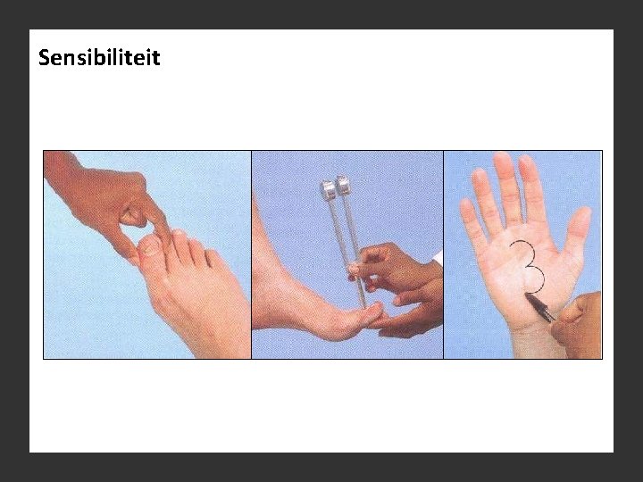 Neurologische Observatie Dr Peter Vanacker Overzicht Neuroobservatie A