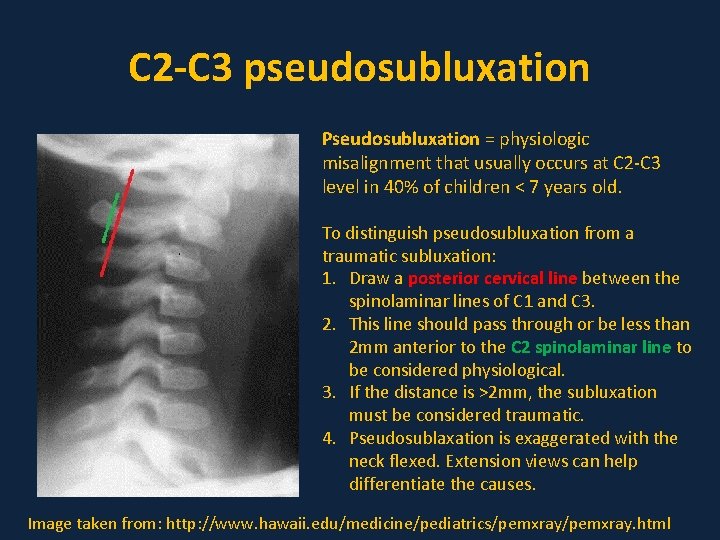 Part 4 0 Standardised Interpretation of Paediatric Cervical