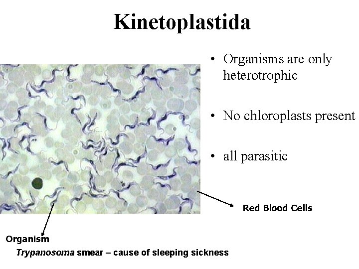 SubKingdom Protozoa General Characteristics Singlecelled or unicellular ...