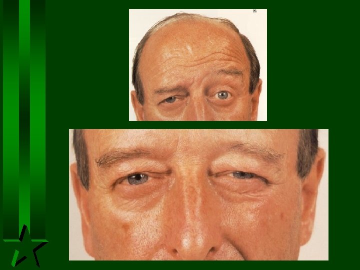 The Face and Facial Expression 235 Human Anatomy