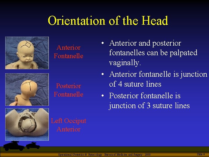 Problems During Labor and Delivery CAPT Mike Hughey