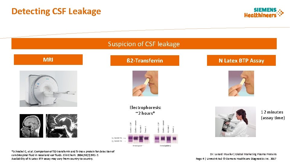 Betatrace Protein A New Biomarker for CSF Leakage