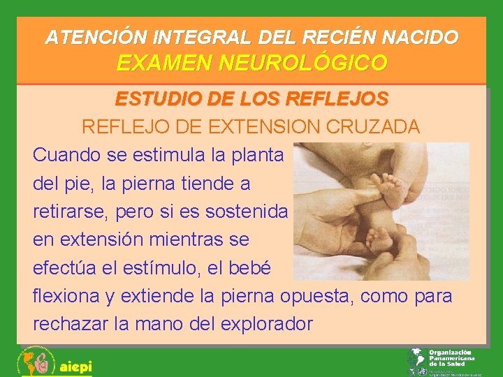 ATENCIN INTEGRAL DEL RECIN NACIDO EXAMEN NEUROLGICO DEL