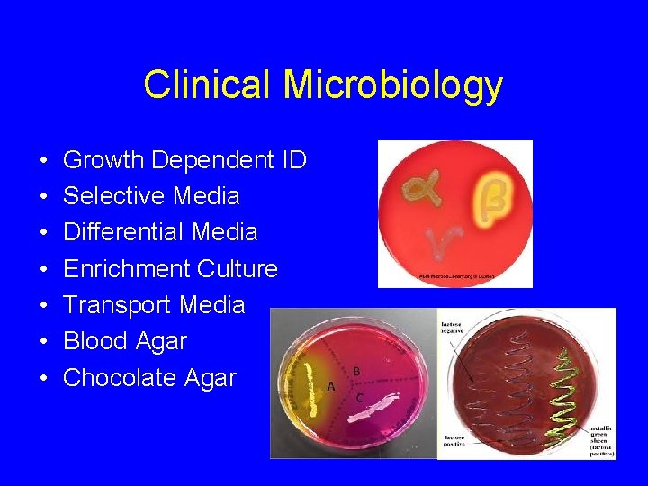 Clinical Microbiology Growth Dependent ID Selective Media Differential