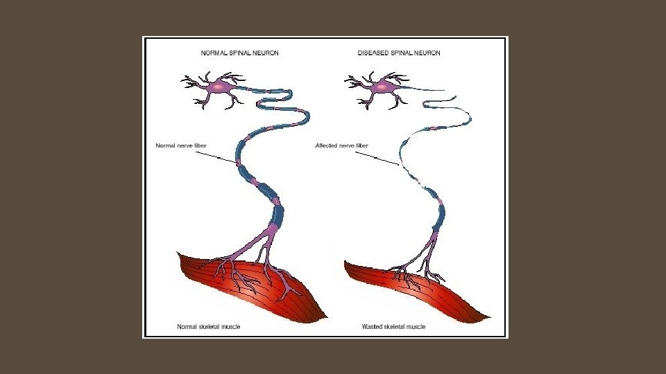 PATIENT 5 ANDREW Ashton Crowe Rayvin Ewers Miranda