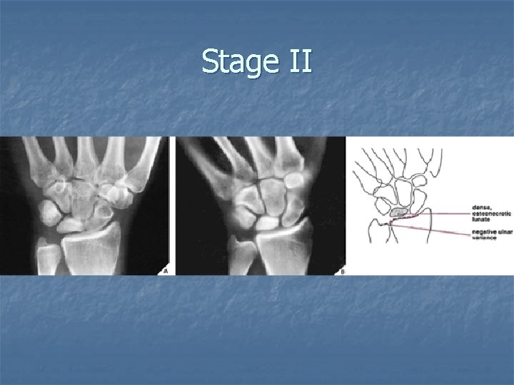 Fractures and dislocations of the wrist Dr Ihab