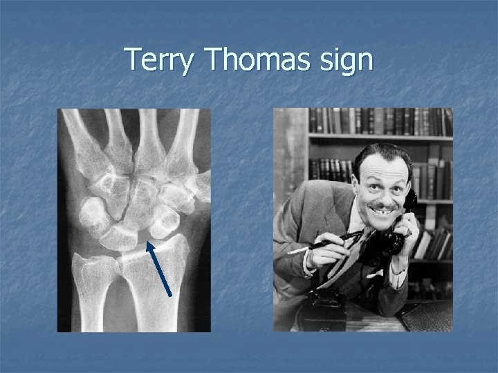 Fractures and dislocations of the wrist Dr Ihab