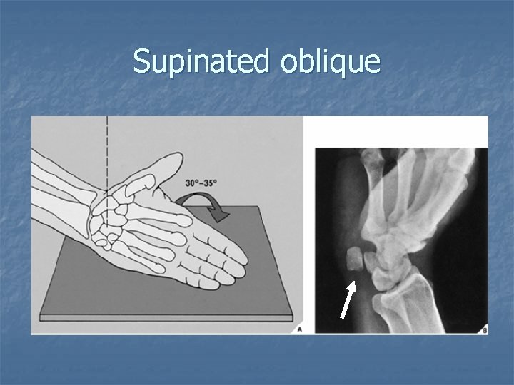 Fractures and dislocations of the wrist Dr Ihab