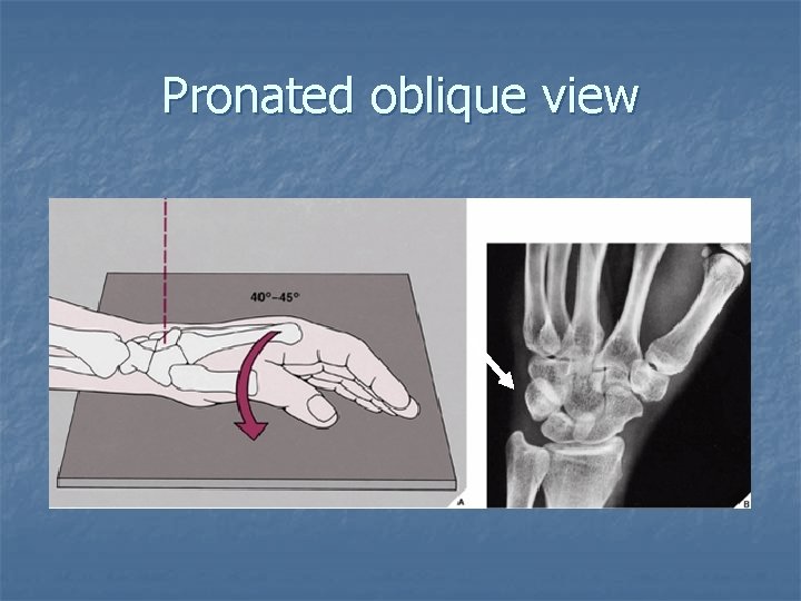 Fractures and dislocations of the wrist Dr Ihab