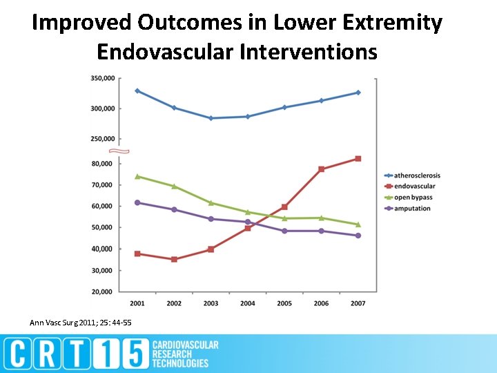 Crossing SFA CTO with a Wire William Bachinsky