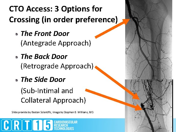 Crossing SFA CTO with a Wire William Bachinsky