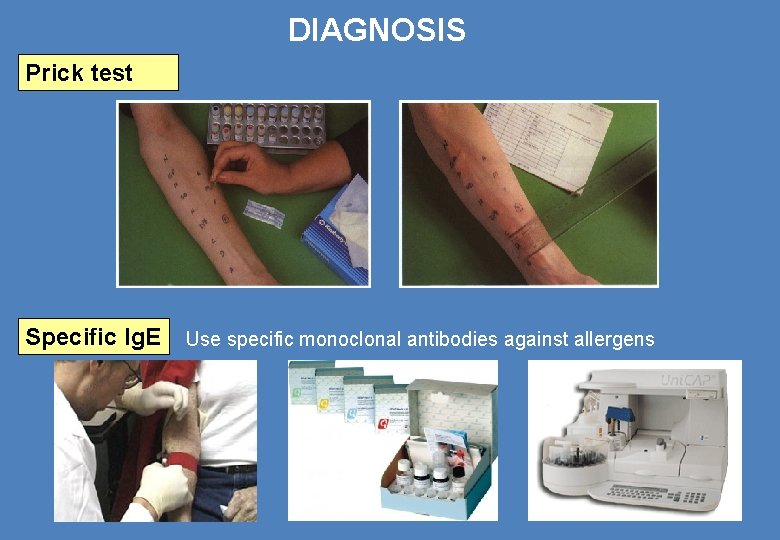 ANGIOEDEMA LARYNGEAL EDEMA DIAGNOSIS AND MANAGEMENT Henriette Farkas