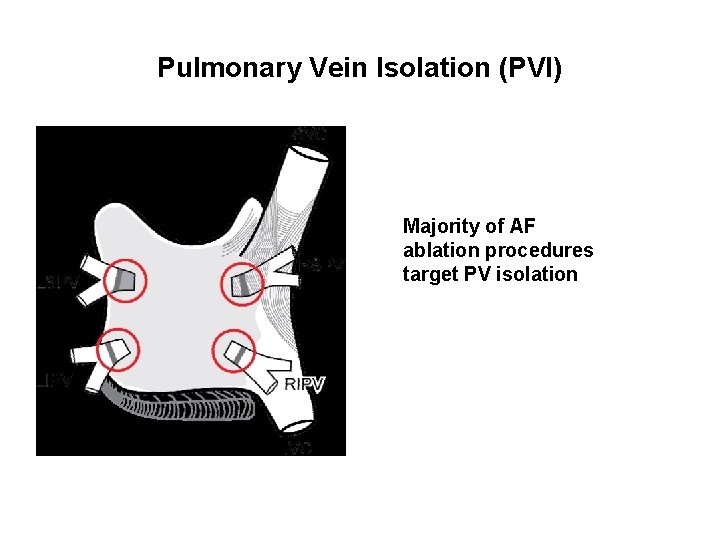 Whats New in the EP Lab Technologies to