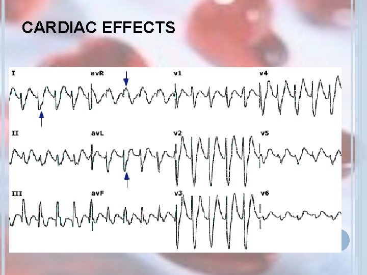 TRICYCLIC ANTIDEPRESSANTS POISONING TRICYCLIC ANTIDEPRESSANTS ...