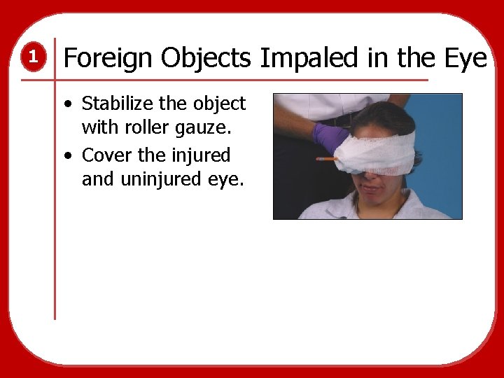 SeattleKing County EMTB Class Topics 1 Eye Injuries