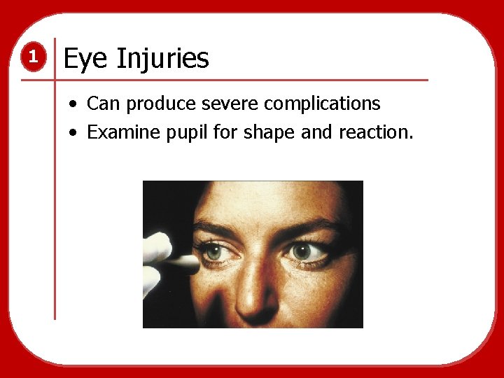 SeattleKing County EMTB Class Topics 1 Eye Injuries