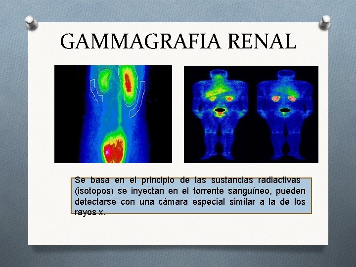 FUNCION VALORACION Y MEDIDAS TERAPEUTICAS DEL SISTEMA URINARIO