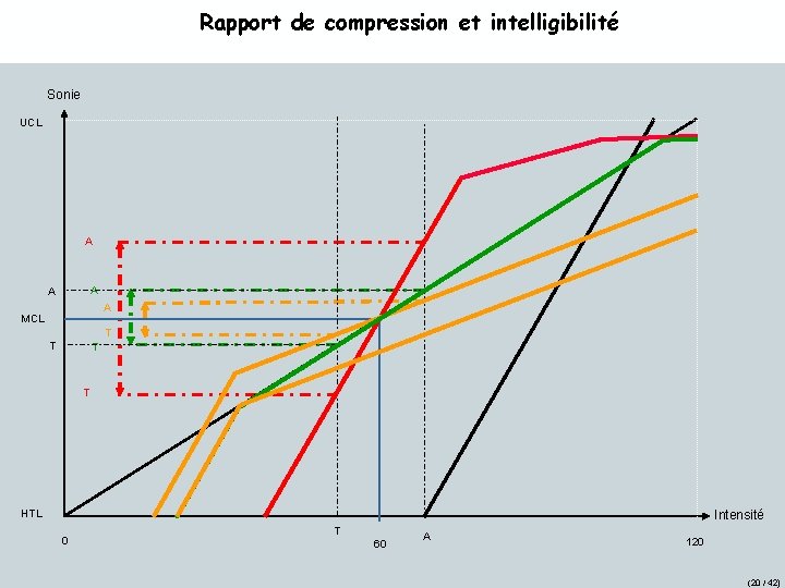 La Compression philippe lantinsiemens com Sons perception sensation