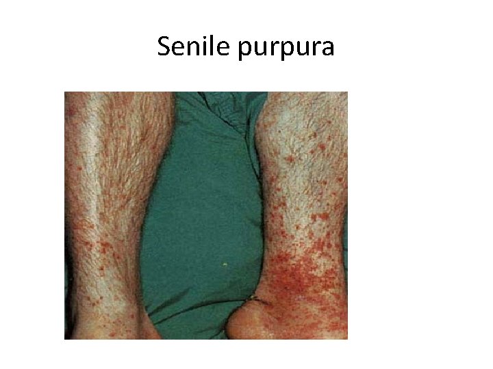 Assessment of markers and symptoms of possible elder