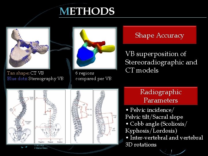 LowDose Digital Stereoradiography vs Computed Tomography Validation of