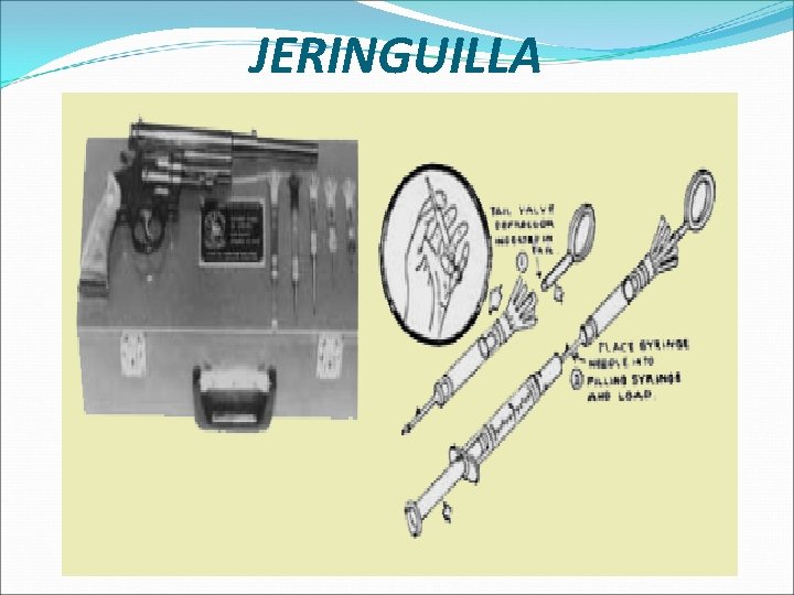 INYECTOLOGIA HISTORIA DE LA JERINGA ENFERMERIA INTEC 2008